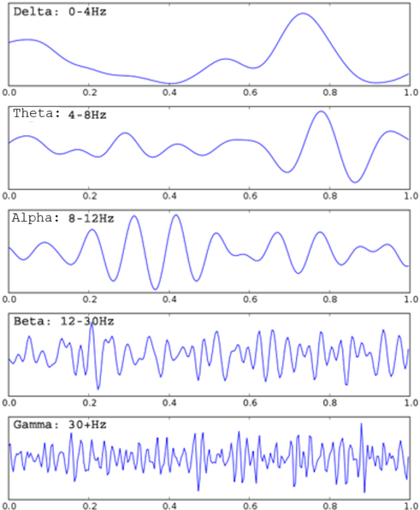 Dry Electrode - Wearable Sensing | Dry EEG