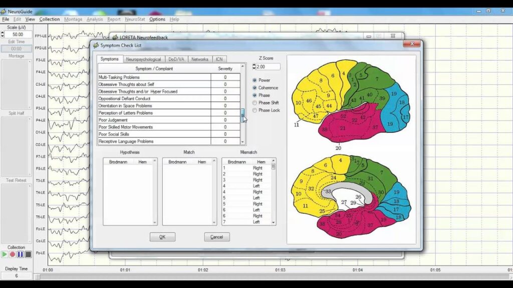 Neurofeedback - Wearable Sensing | Dry EEG